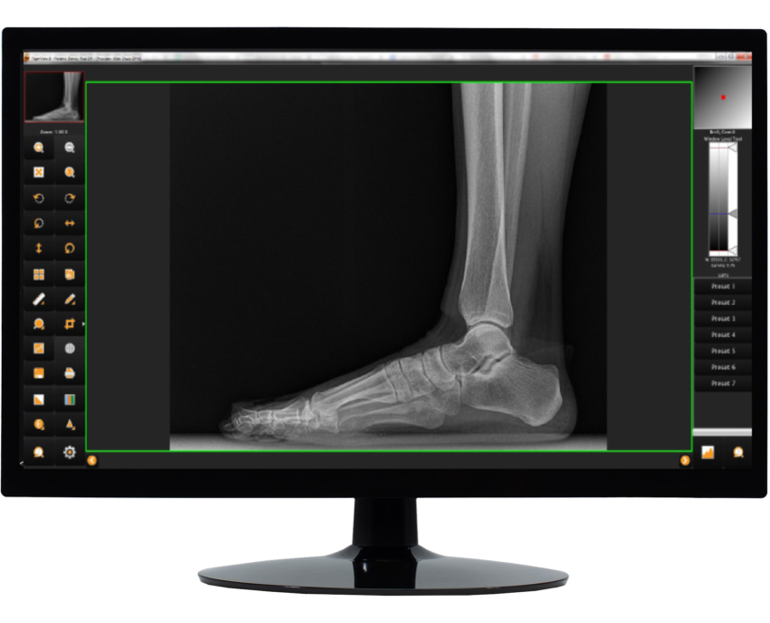 X-ray & DR - ImagPros